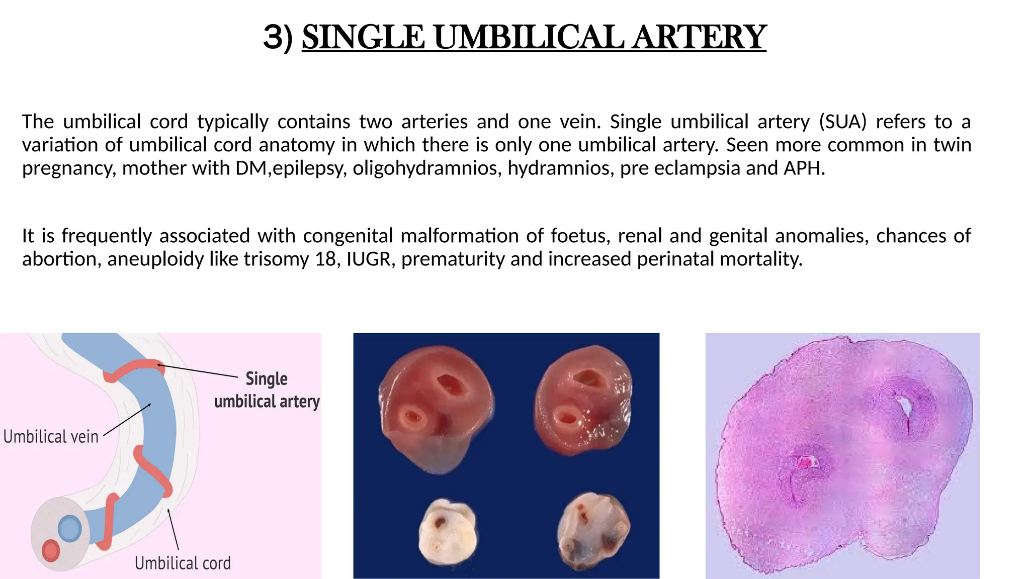 UMBILICAL CORD.................................... | PPTX
