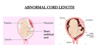UMBILICAL CORD.................................... | PPTX