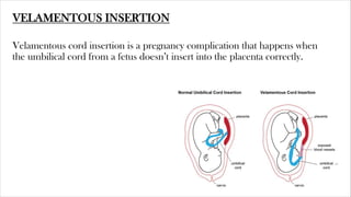 UMBILICAL CORD deformities -Dr. ARCHANA ASOK.pdf