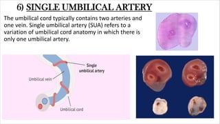 UMBILICAL CORD deformities -Dr. ARCHANA ASOK.pdf