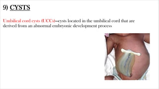 UMBILICAL CORD deformities -Dr. ARCHANA ASOK.pdf