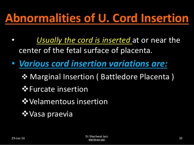 UMBILICAL CORD ABNORMALITIES & ITS OBSTETRIC OUTCOME BY DR SHASHWAT J…