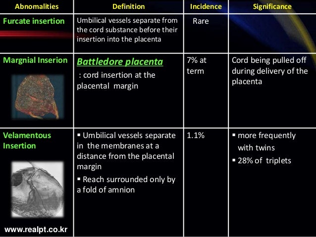 UMBILICAL CORD ABNORMALITIES & ITS OBSTETRIC OUTCOME BY DR SHASHWAT J…