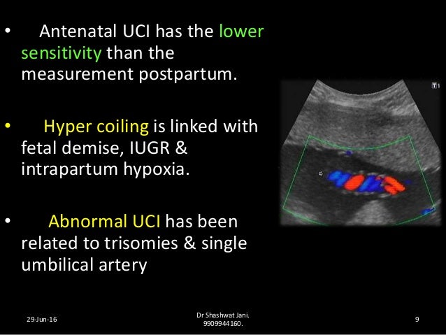 UMBILICAL CORD ABNORMALITIES & ITS OBSTETRIC OUTCOME BY DR SHASHWAT J…