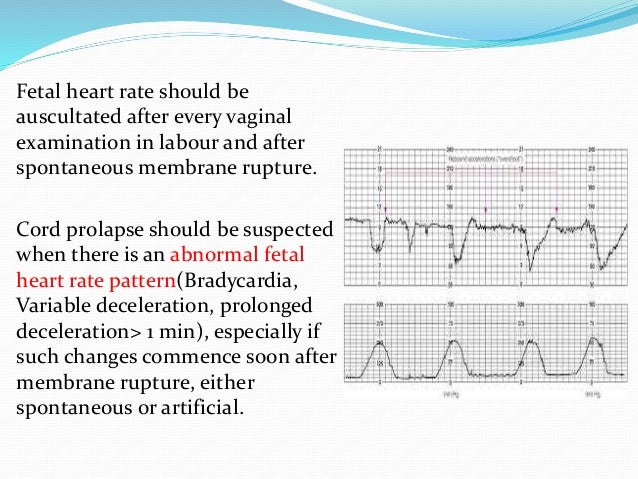 Umbilical cord prolapse