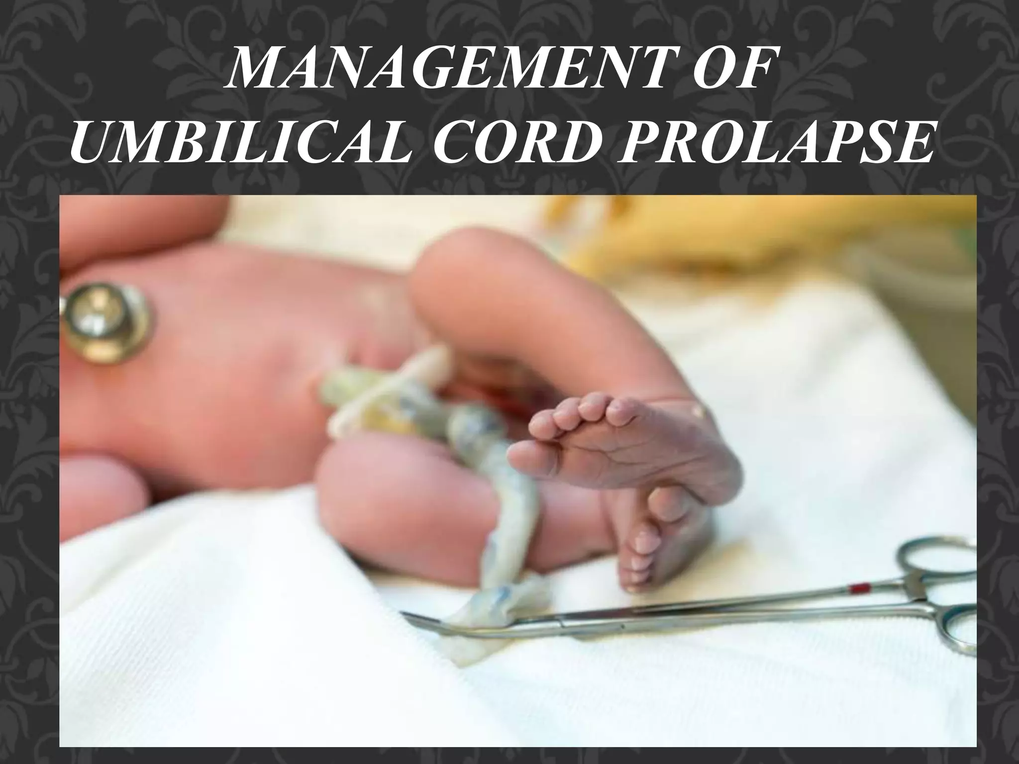 Umbilical Cord Prolapse, Presented By Mohammed Haroon Rashid | PPTX