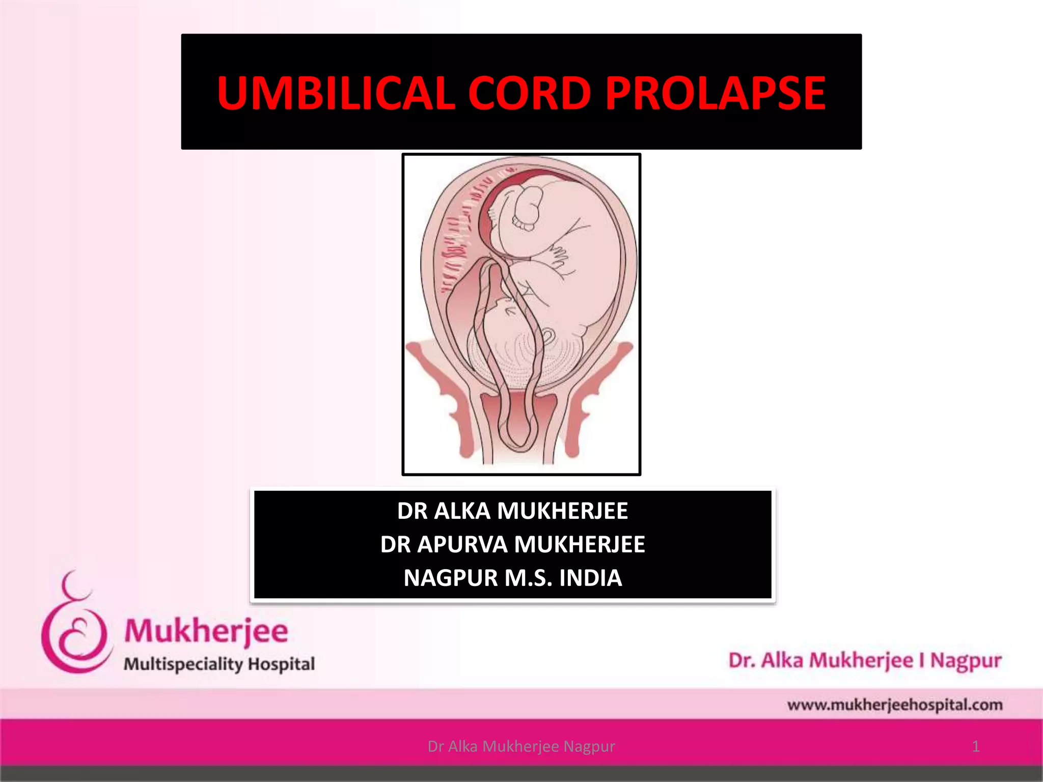 Umbilical cord prolapse by dr alka mukherjee dr apurva mukherjee nagpur ...