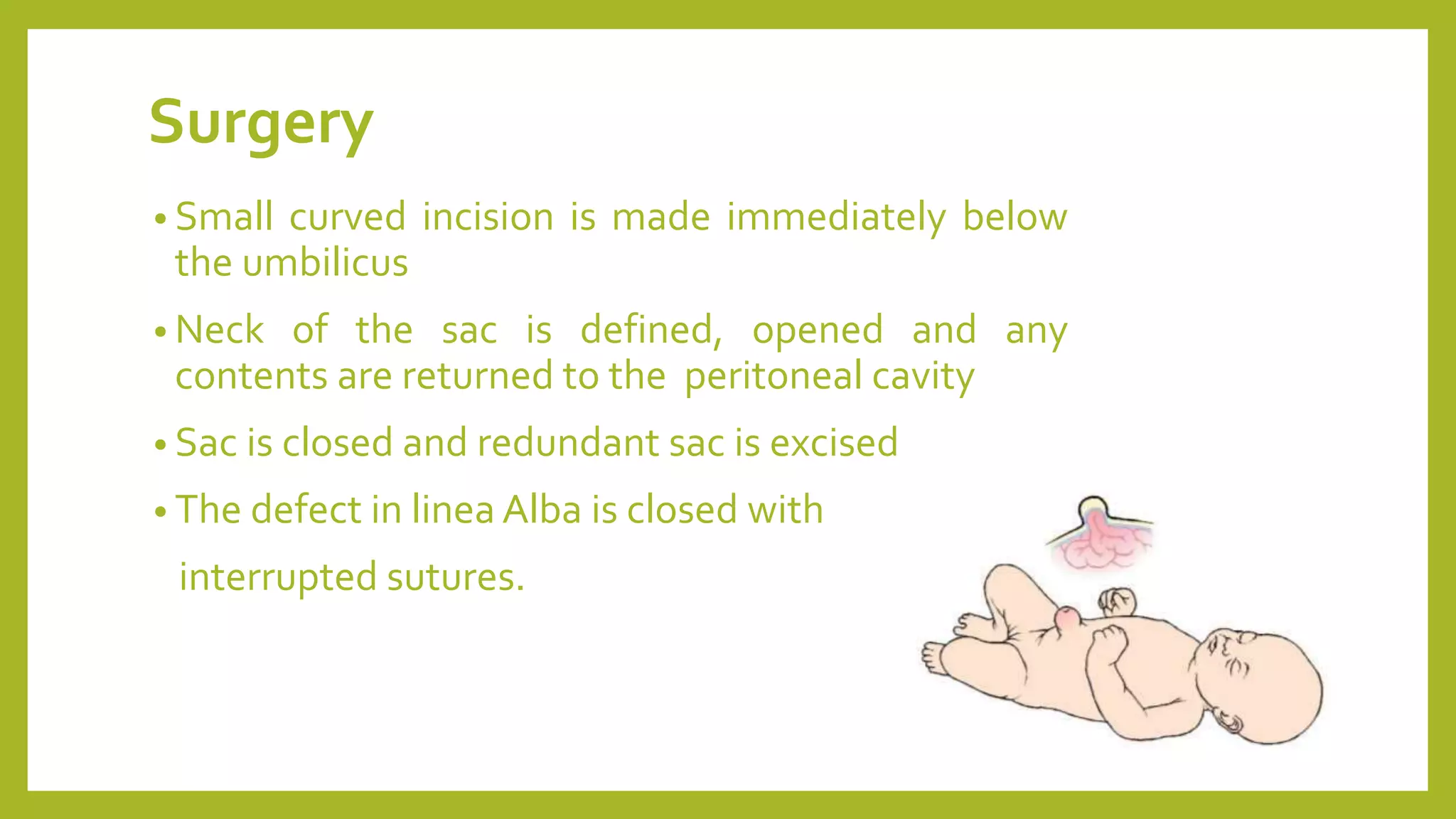 Umbilical hernia | PPTX