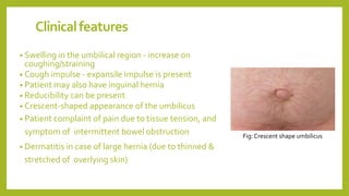 Umbilical hernia | PPTX