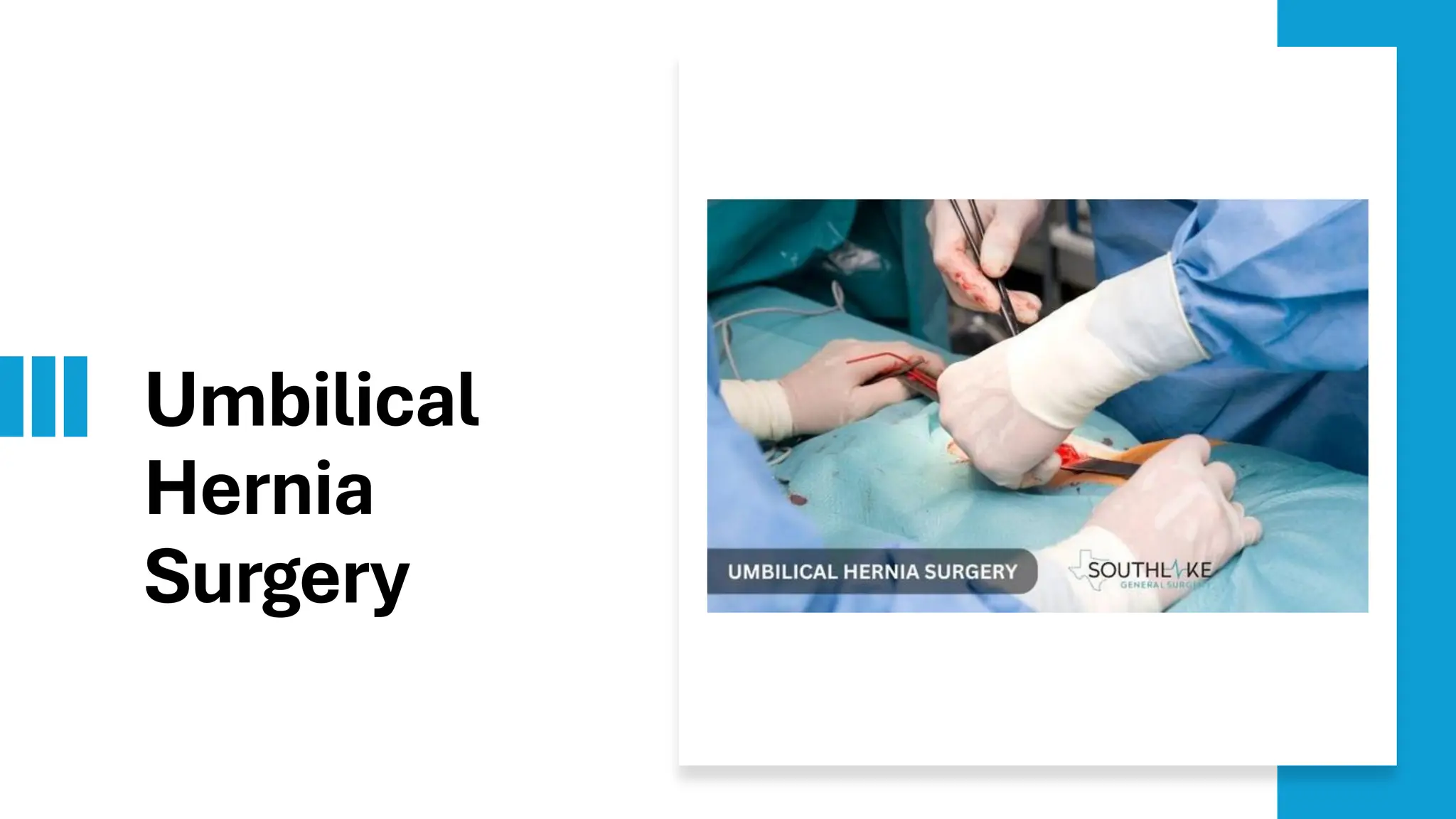 Umbilical Hernia Repair Explained-Southlake General Surgery.pdf
