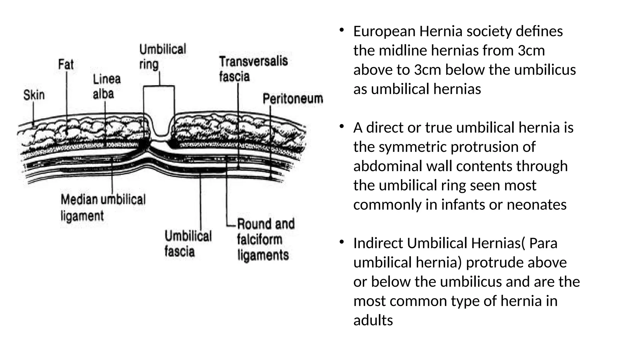 Umbilical Hernia- A Comprehensive presentation on various surgical ...