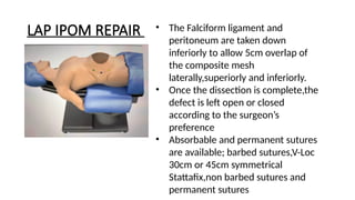 Umbilical Hernia- A Comprehensive presentation on various surgical ...