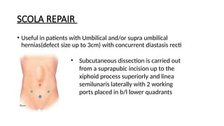 Umbilical Hernia- A Comprehensive presentation on various surgical ...