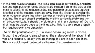 Umbilical Hernia- A Comprehensive presentation on various surgical ...