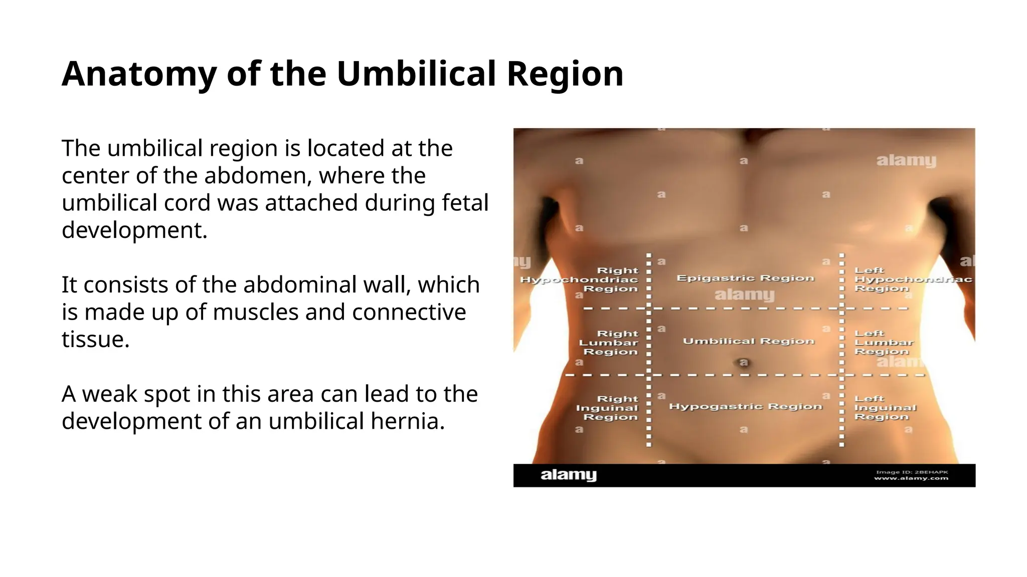 Umbilicalis Hernia - about hernia of umblical | PPTX