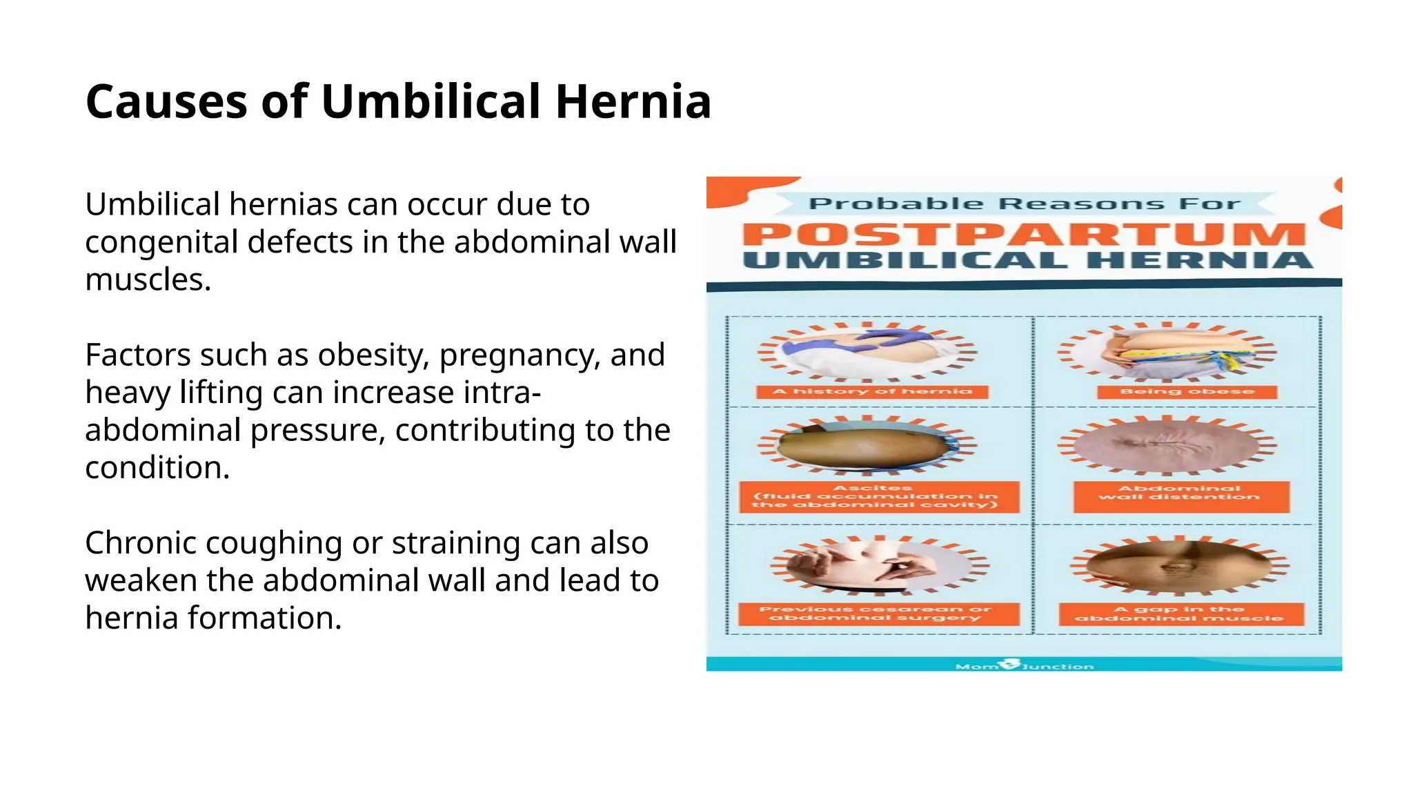 Umbilicalis Hernia - about hernia of umblical | PPTX