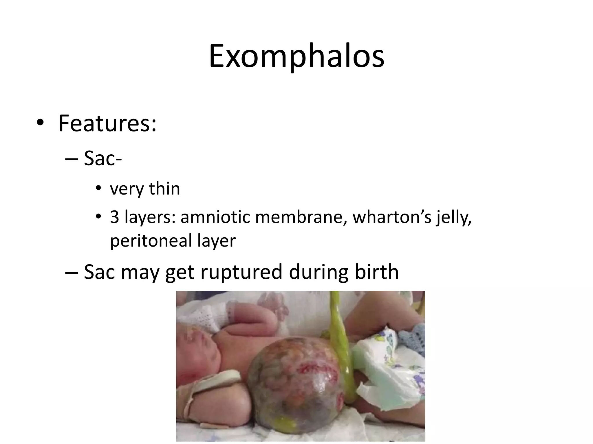 Umbilical, paraumbilical, incisional hernia revision | PPTX