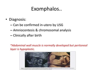 Umbilical, paraumbilical, incisional hernia revision | PPTX