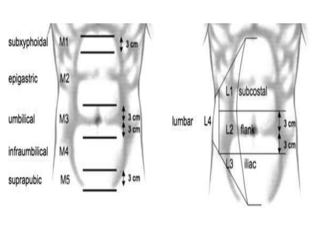 Umbilical, paraumbilical, incisional hernia revision | PPTX