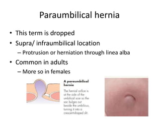 Paraumbilical Hernia