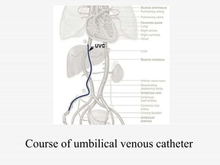 Neonatal Umbilical Venous Catherization Radiology | PPT