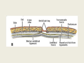 Umbilicus disease | PPTX