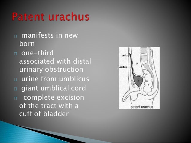 diseases of Umbilicus