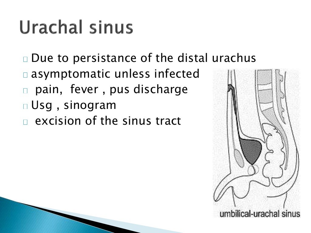 diseases of Umbilicus