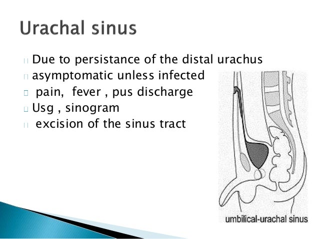 diseases of Umbilicus