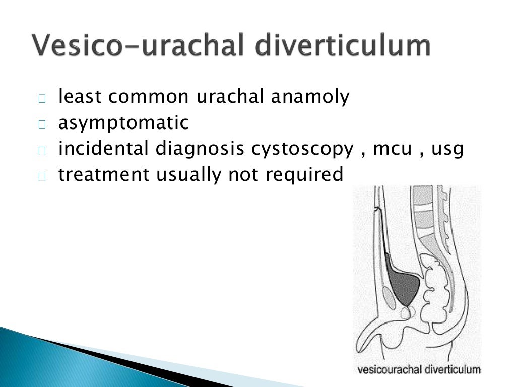 diseases of Umbilicus