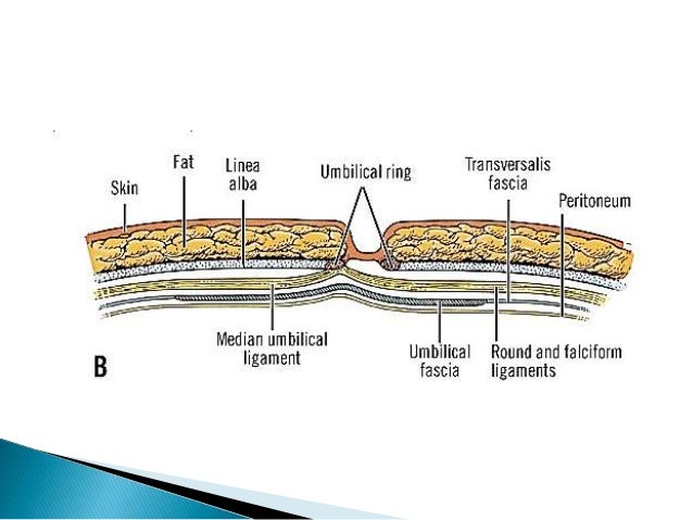 diseases of Umbilicus