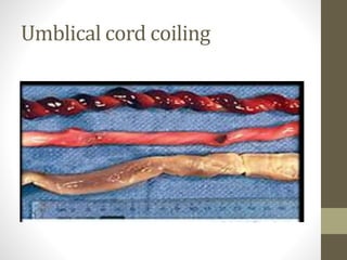 Umblical cord and abnormalities.pptx