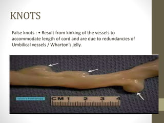 Umblical cord and abnormalities.pptx