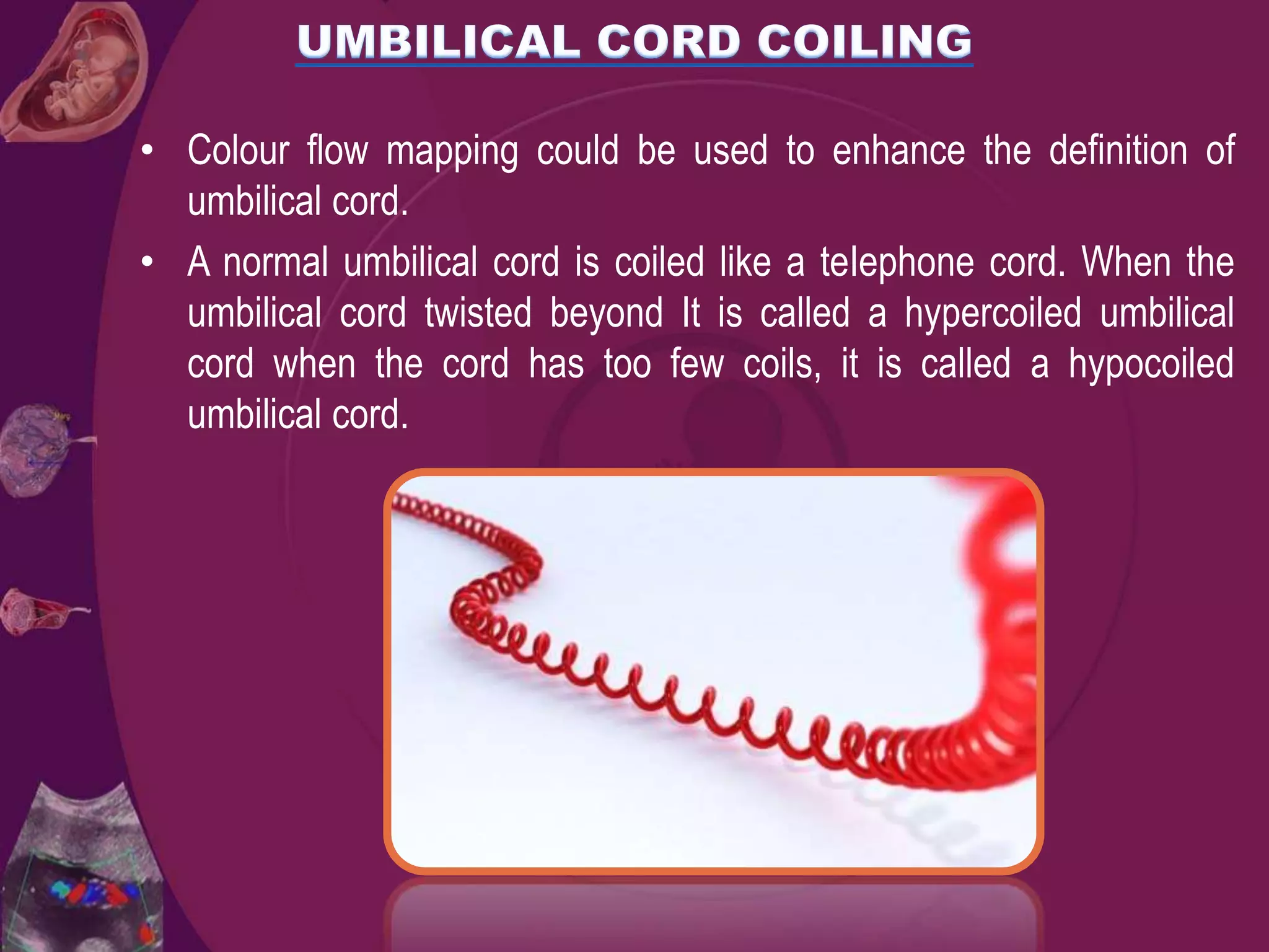 Umblical cord presentation | PPTX