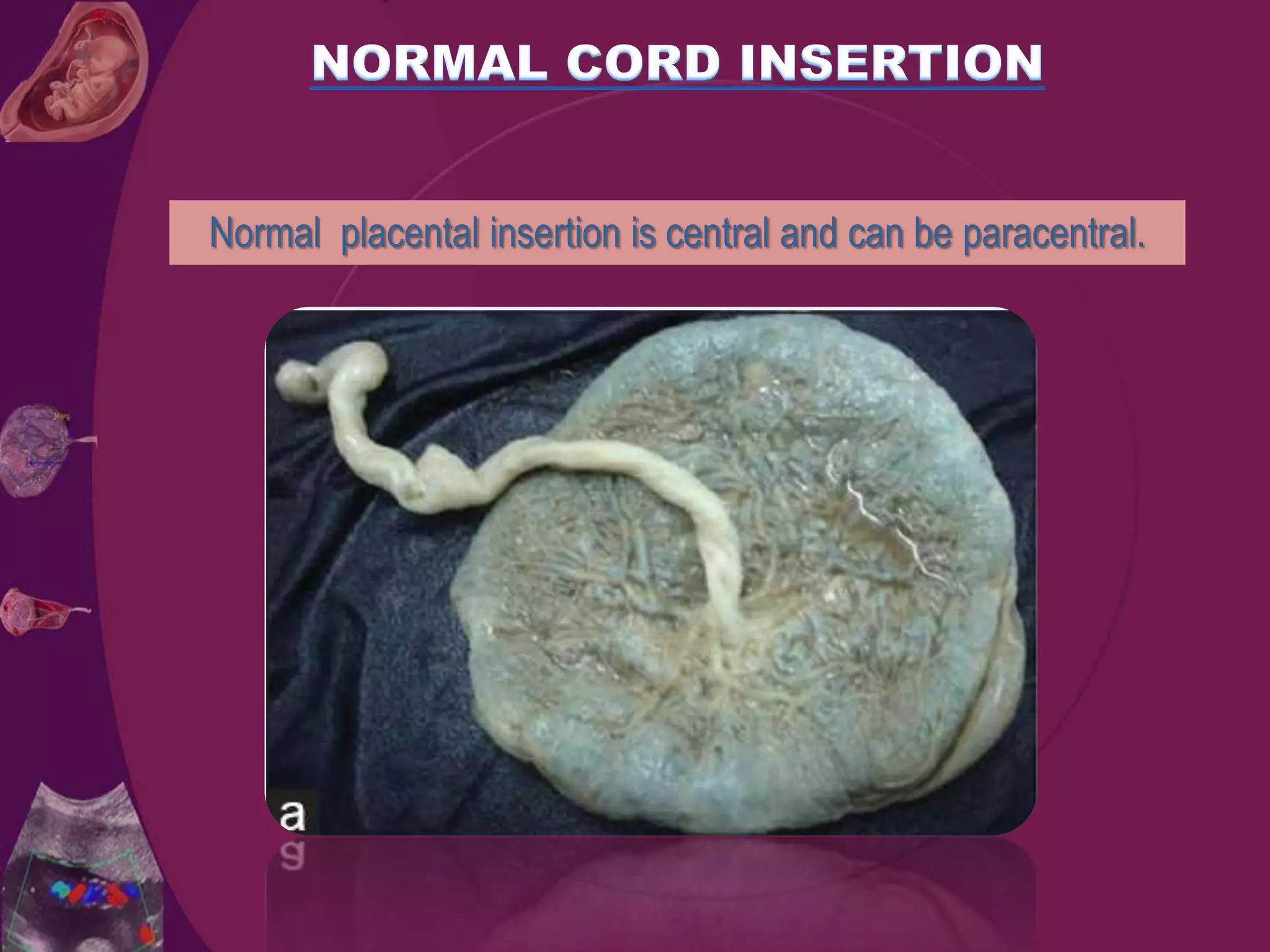 Umblical cord presentation | PPTX