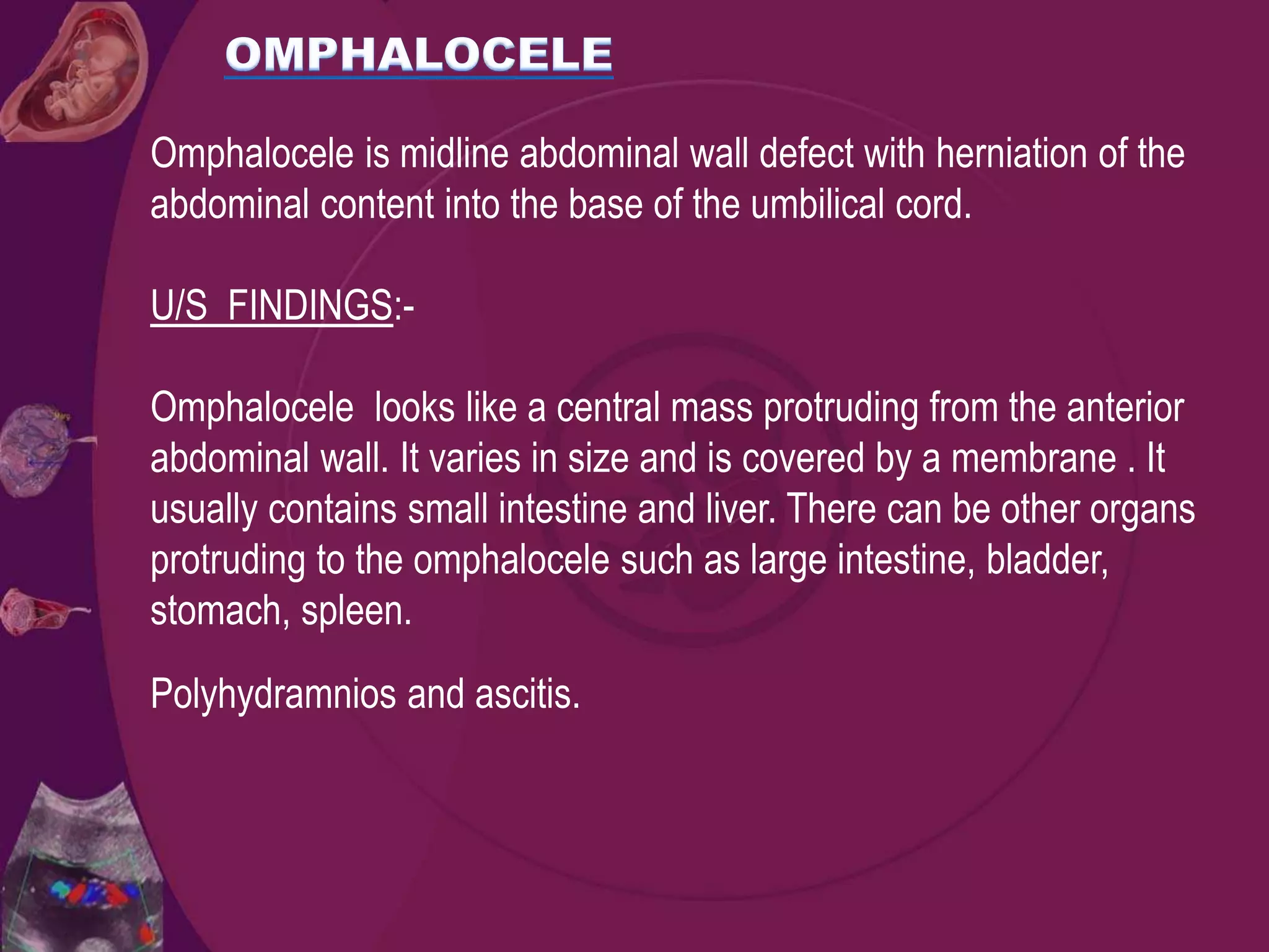 Umblical cord presentation | PPTX