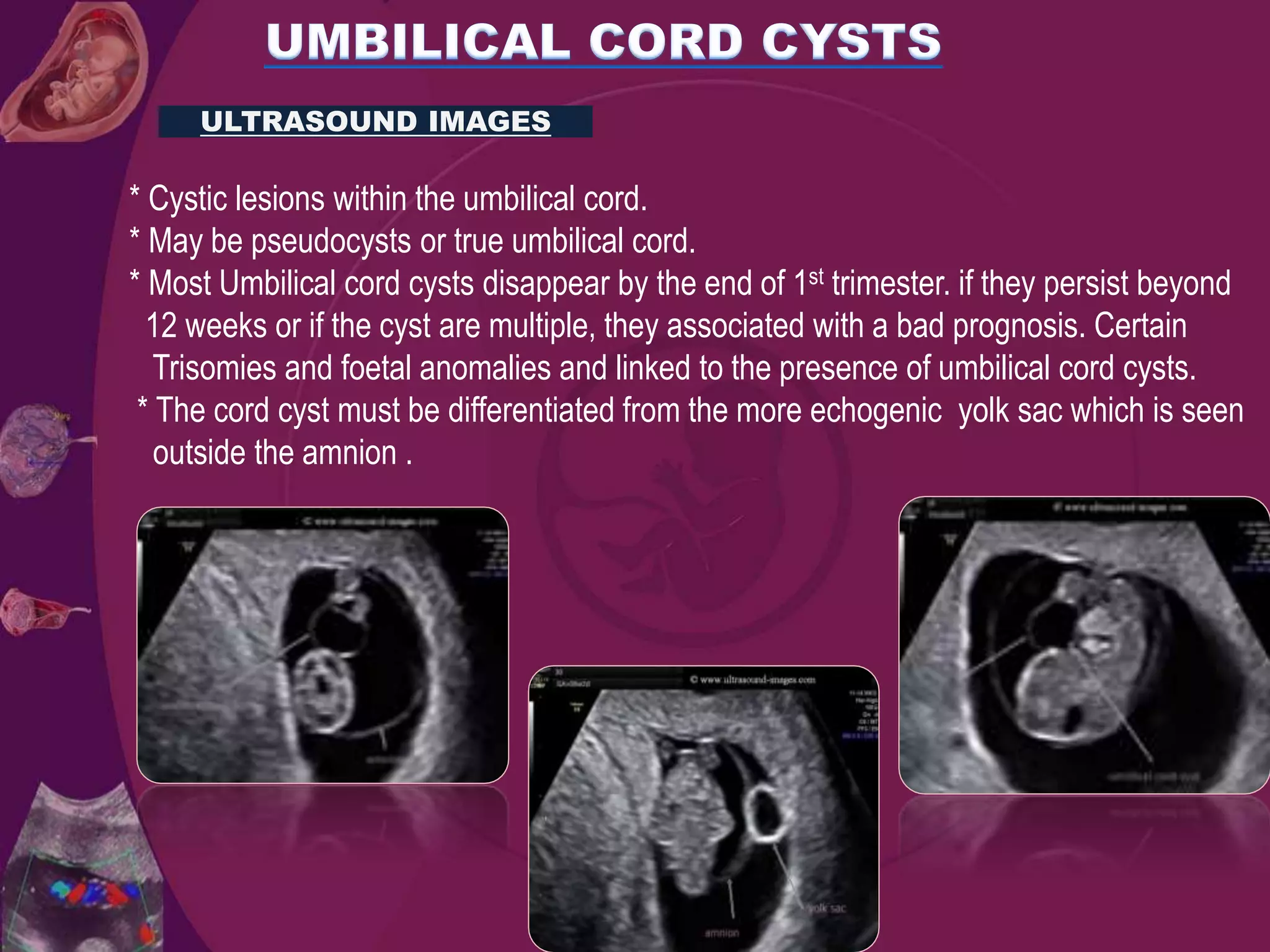 Umblical cord presentation | PPTX