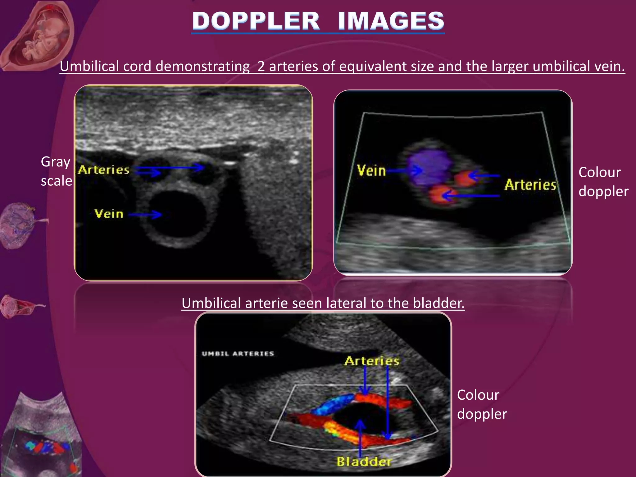 Umblical cord presentation | PPTX
