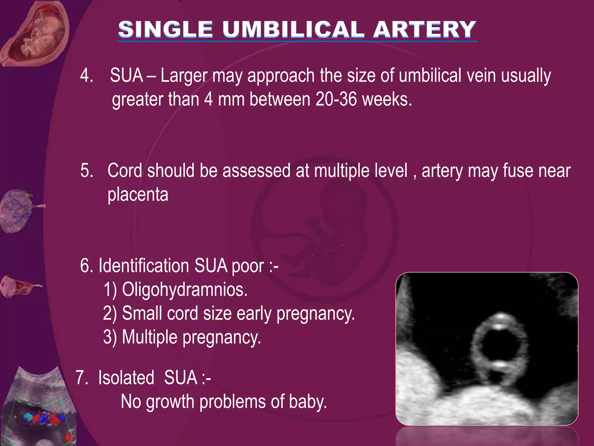 Umblical cord presentation | PPTX