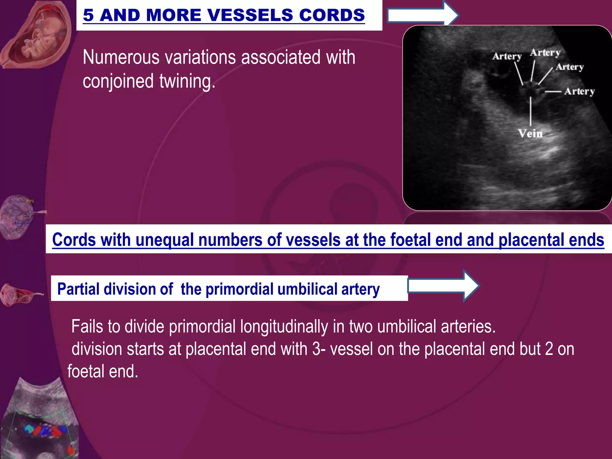 Umblical cord presentation | PPTX