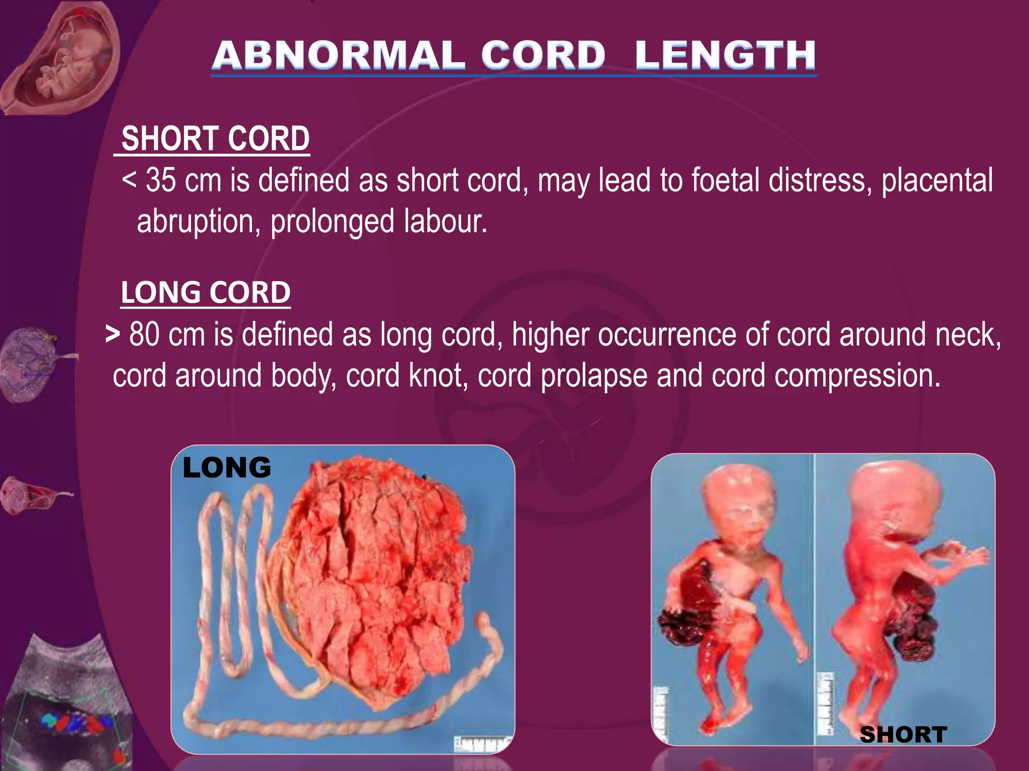 Umblical cord presentation | PPTX