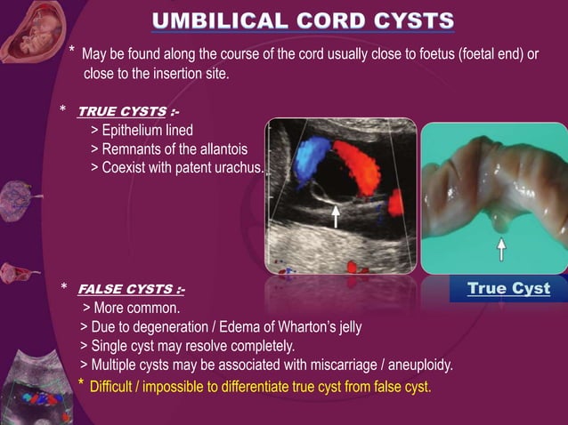 Umblical cord presentation | PPTX
