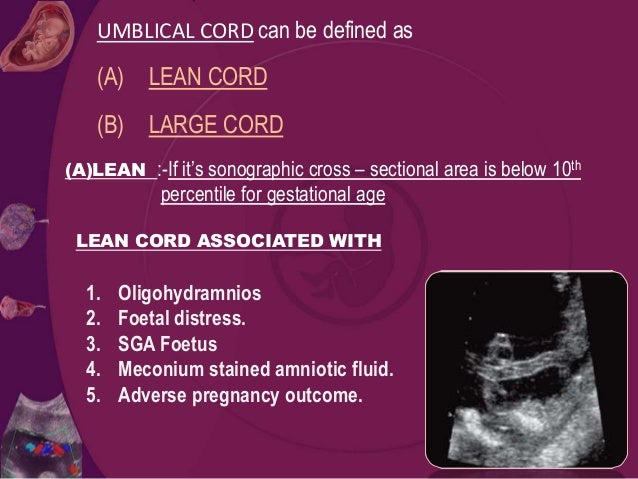 Umblical cord presentation