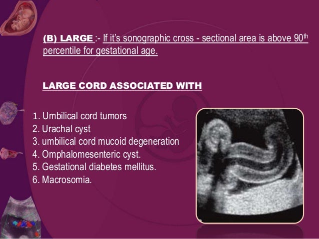 Umblical cord presentation