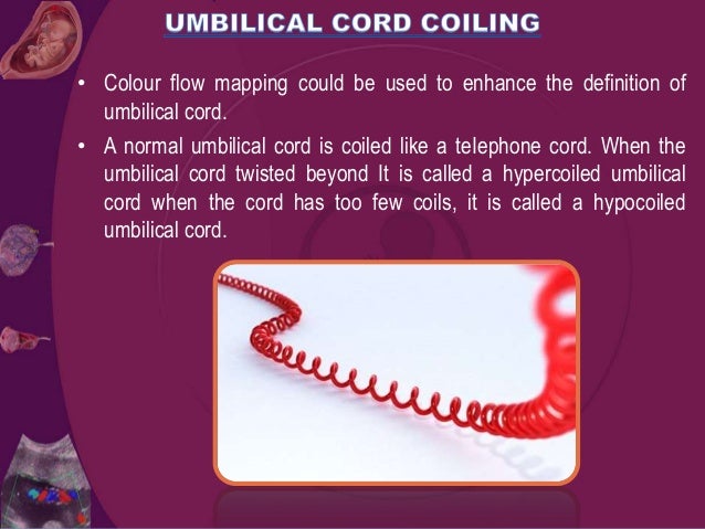 Umblical cord presentation