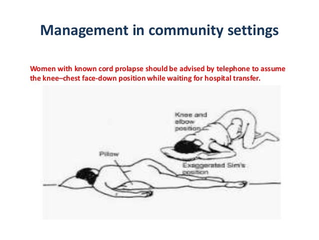 Umblical cord prolapse