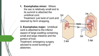 Umblical Hernia By Dr.Pankaj Vishwakarma | PPT
