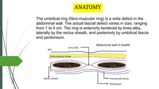 Umblical Hernia By Dr.Pankaj Vishwakarma | PPT
