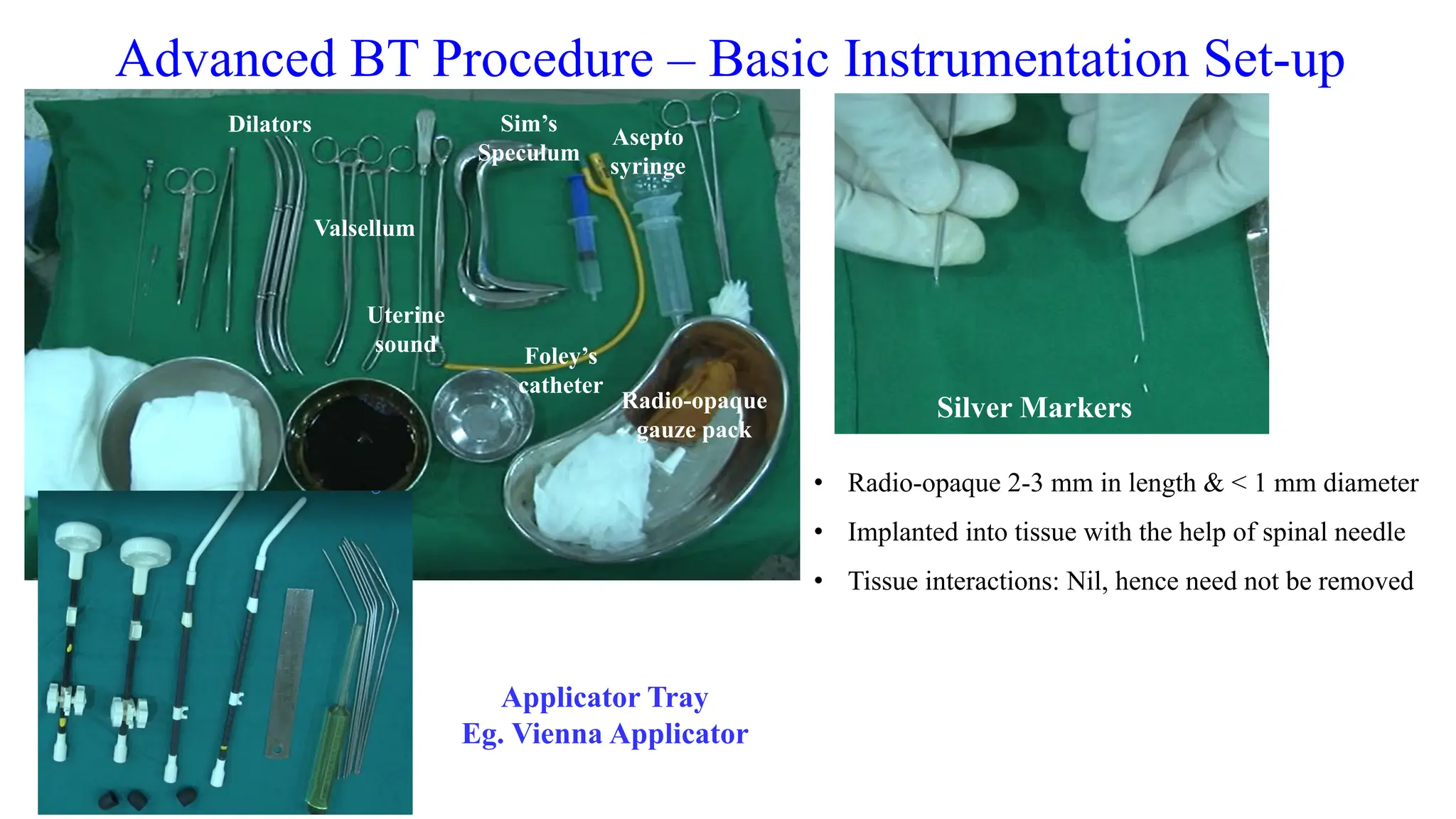 Intracavitary brachytherapy modern day applicators and techniques | PPT