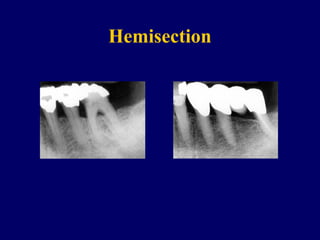 Ummairah | PPT | Dental Health | Diseases and Conditions